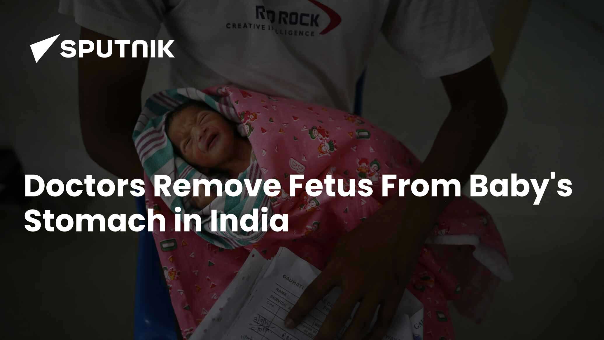 Doctors Remove Fetus From Baby's Stomach in India