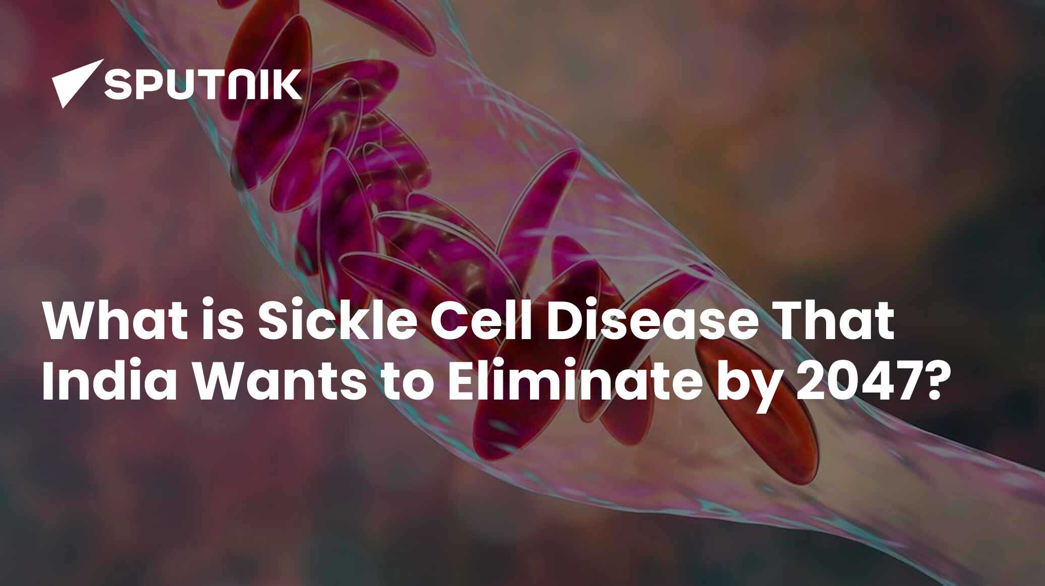 What is Sickle Cell Anemia India Wants to Eliminate by 2047?